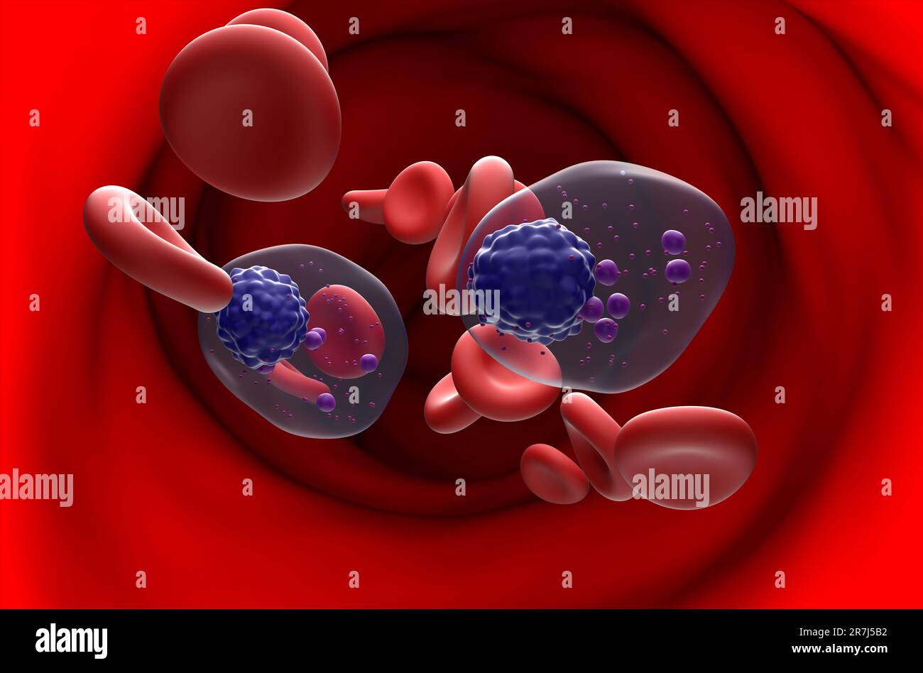 Multiple myeloma cells (MM) in blood flow - section view 3d illustration Stock Photo - Alamy