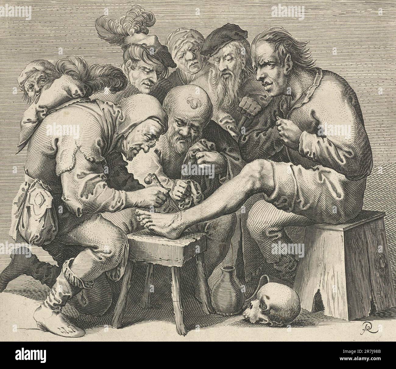 Operation on the foot for teaching purposes by a doctor in the Middle ...