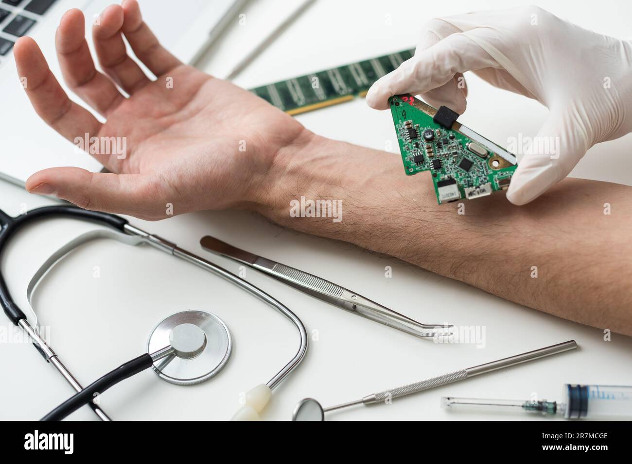 Hand with implantation of micro chip. X-Ray view close-up. Chipization ...