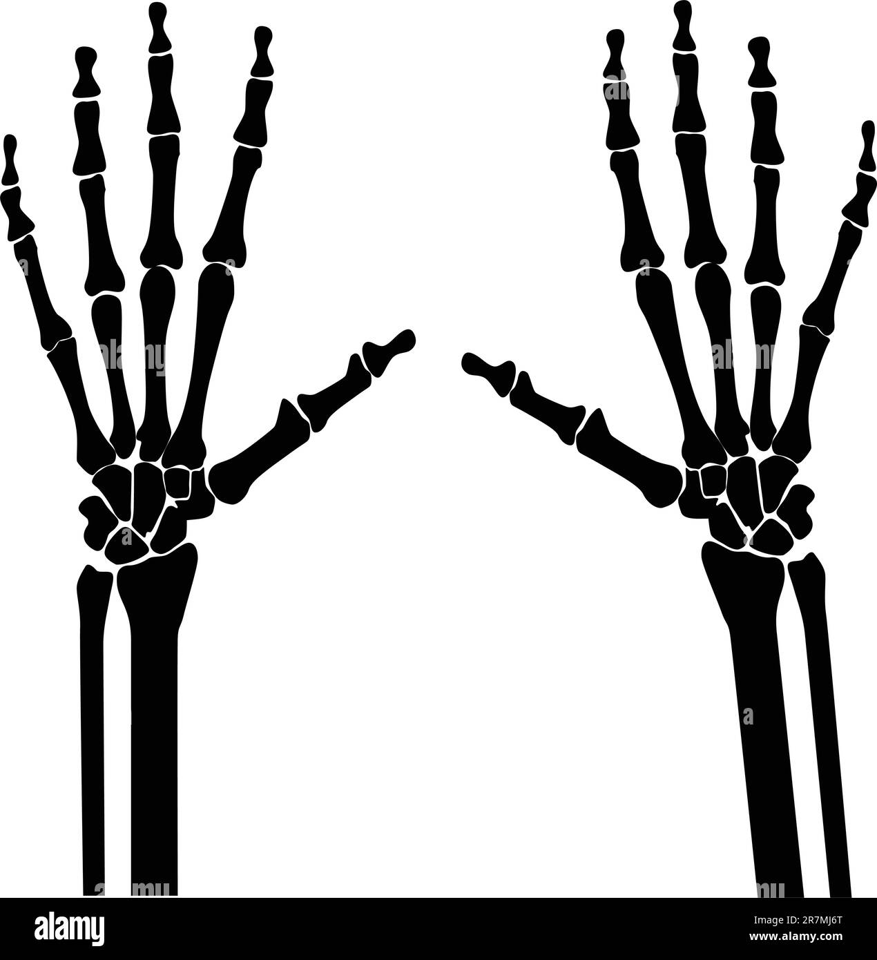 Ray hand arthritis Cut Out Stock Images & Pictures - Alamy