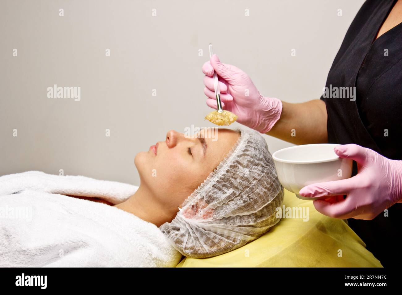 Warts face hi-res stock photography and images - Alamy