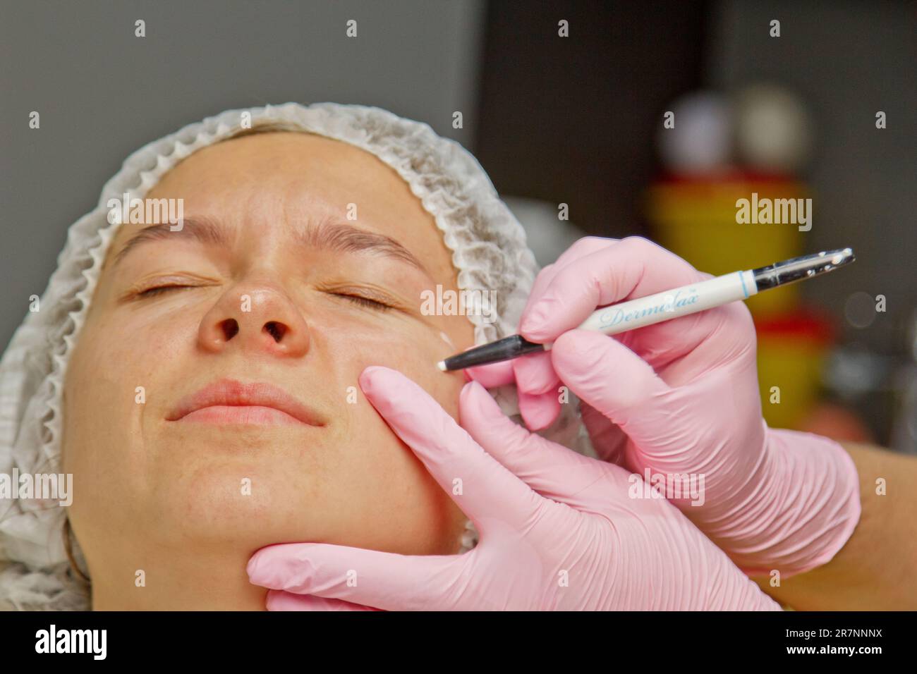 Attractive girl patient with instructions on her face for plastic ...