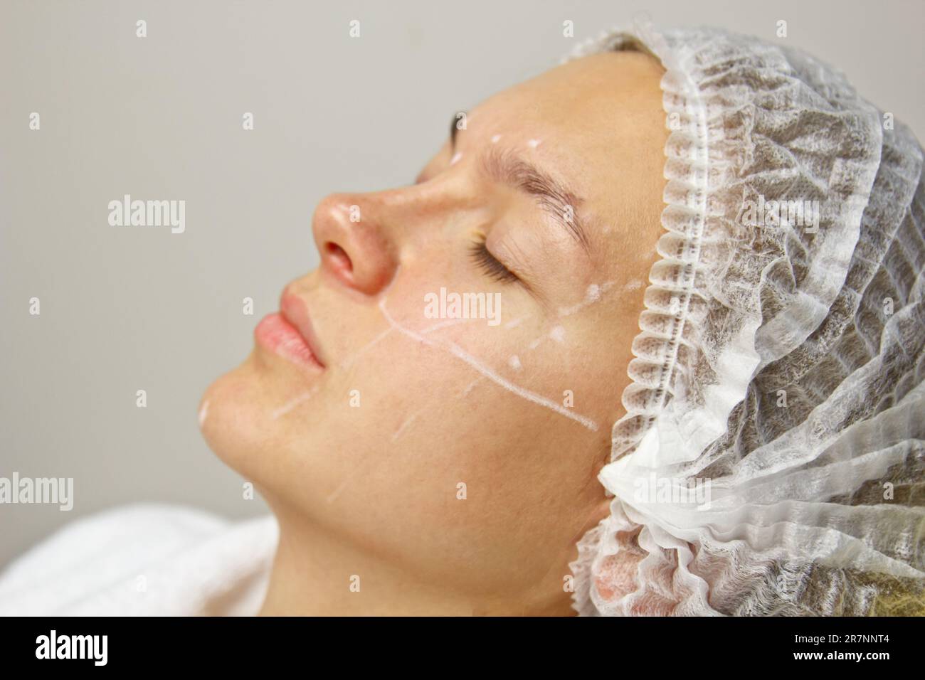 Attractive girl patient with instructions on her face for plastic ...