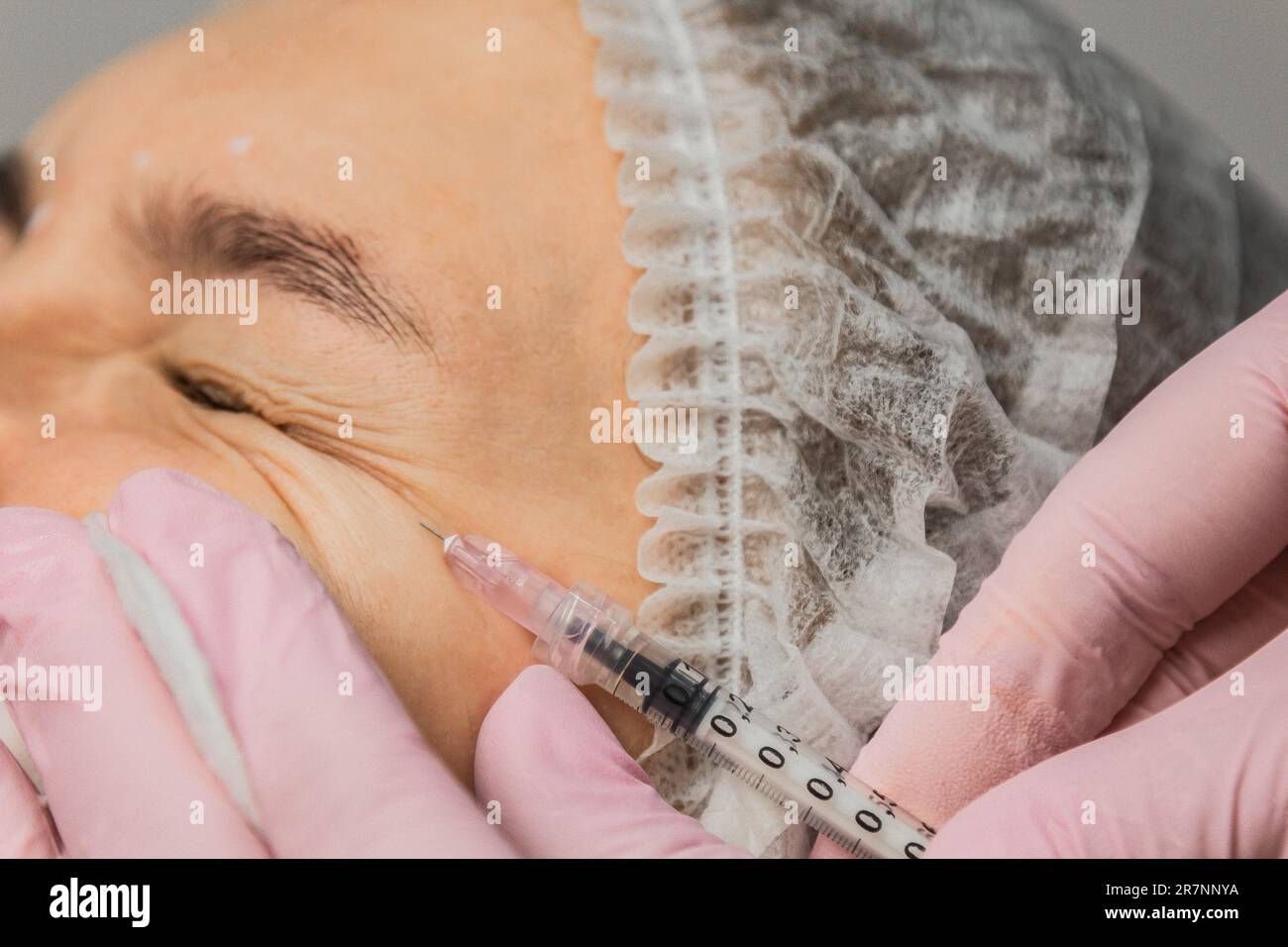 contour plastic. A cosmetologist injects a botulinum toxin to tighten ...