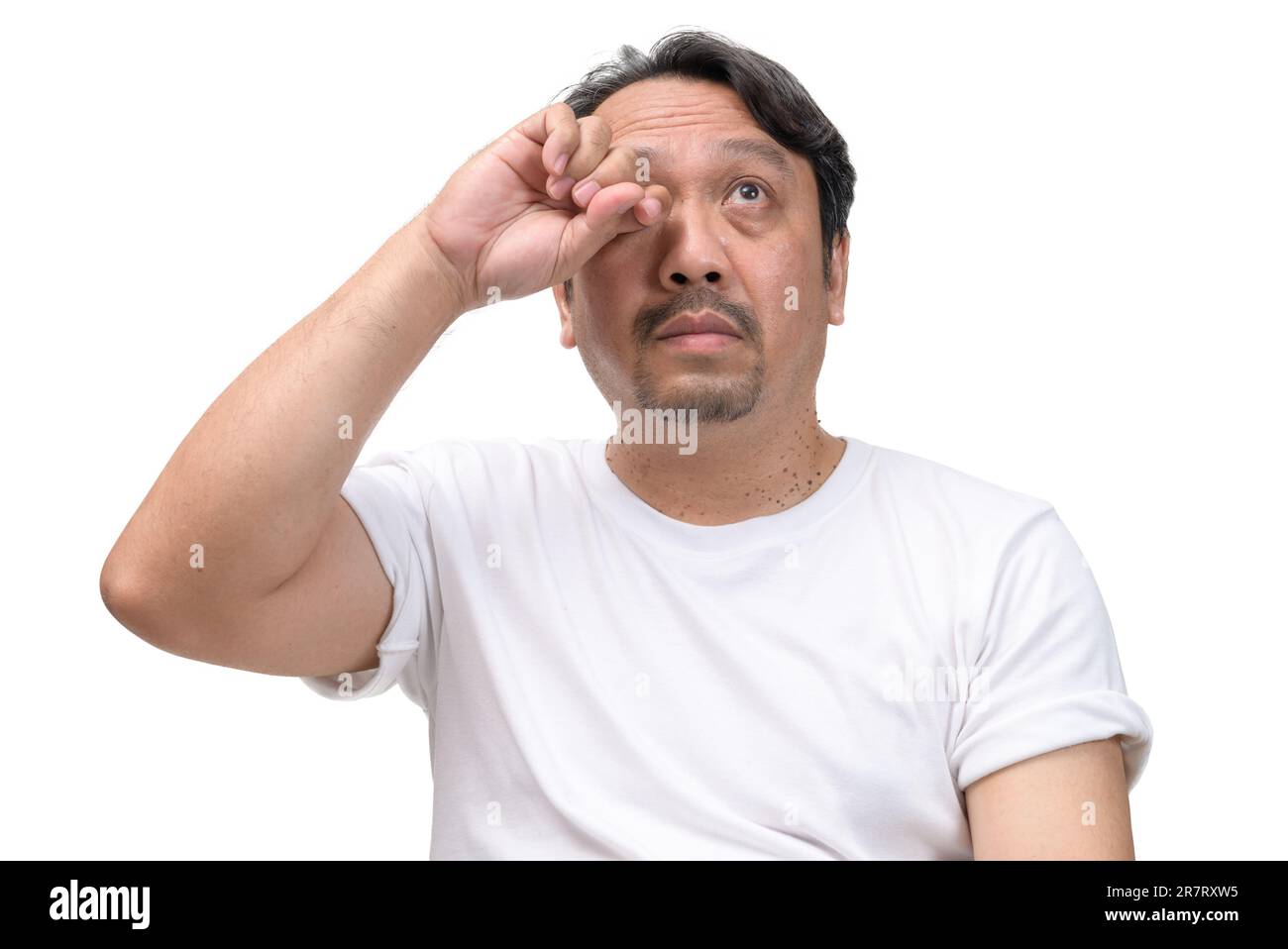 Middle aged man with itchy eye and hand scratching skin isolated on ...