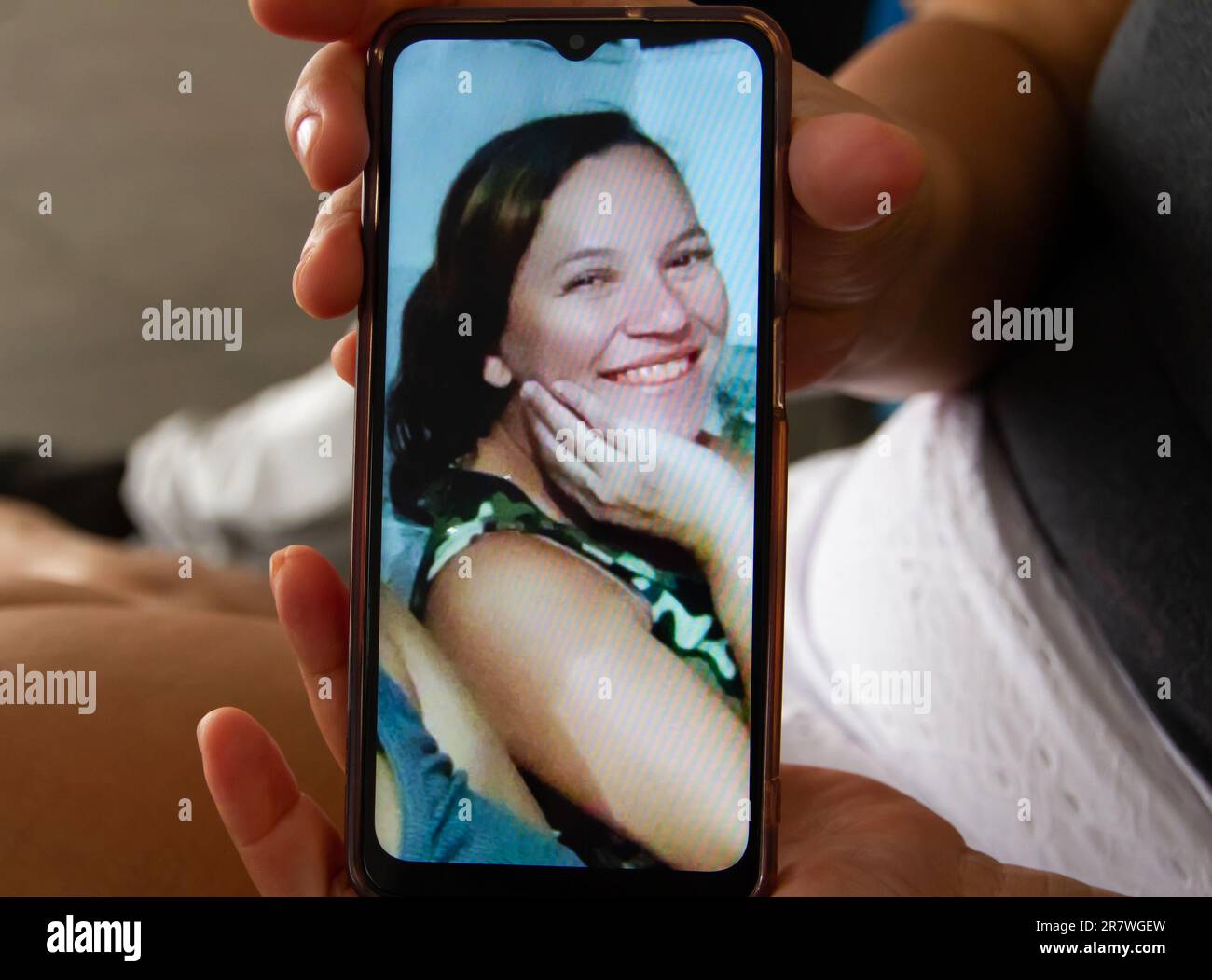 Shrapnel victim hi-res stock photography and images - Alamy