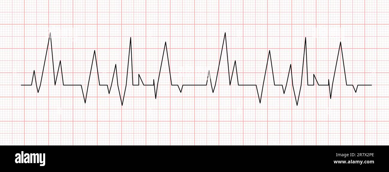 Ecg chart Stock Vector Images - Alamy