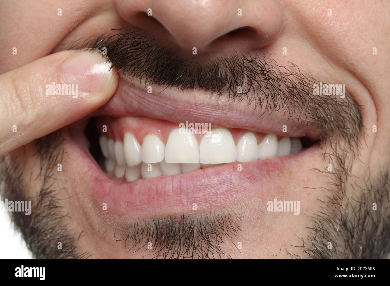 Man showing healthy gums on white background, closeup Stock Photo - Alamy