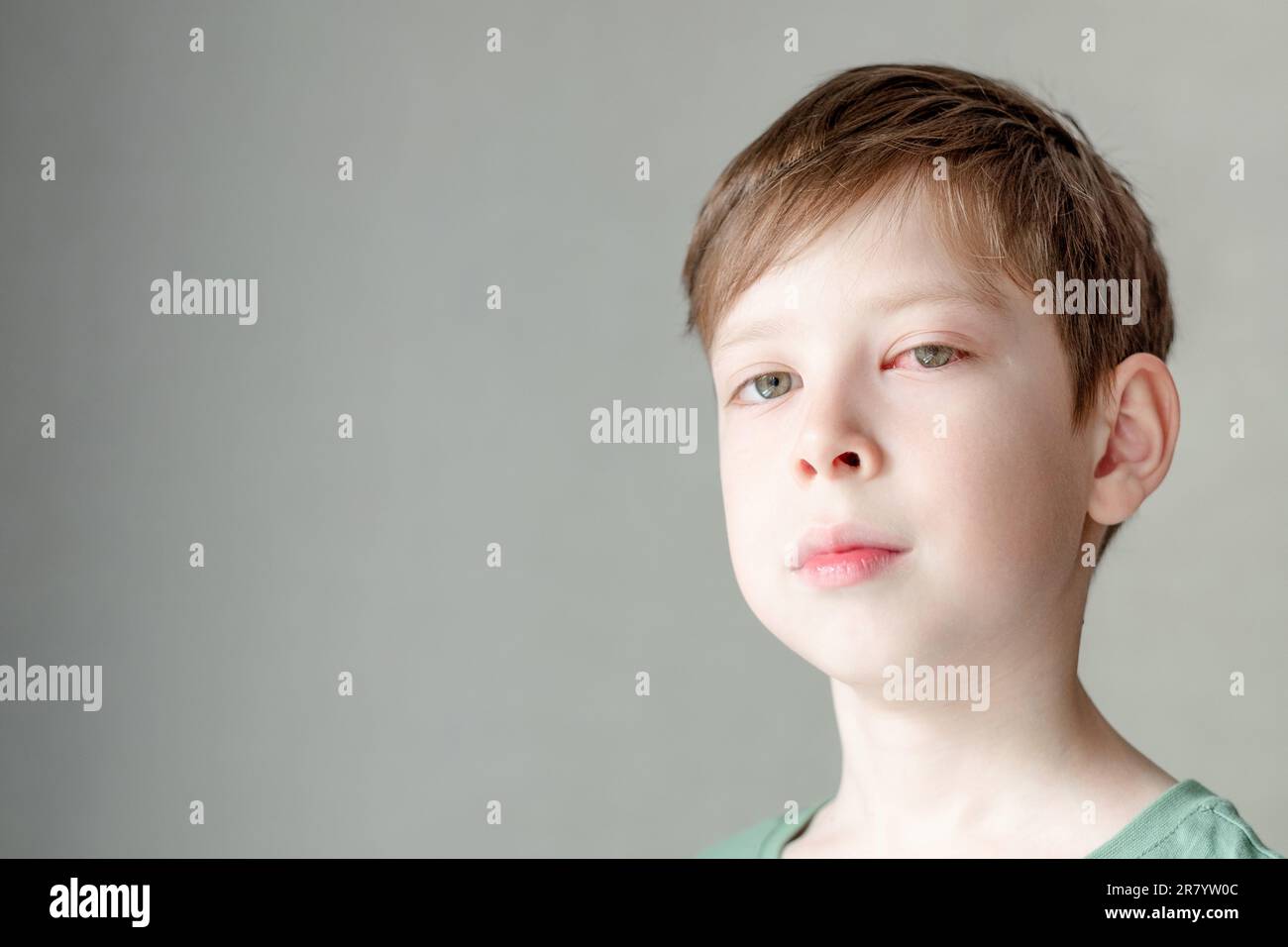 portrait of a boy of European appearance with a red eye from ...
