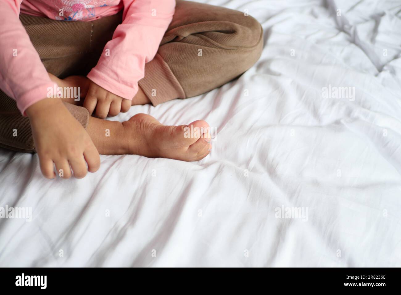 child girl suffering from itching skin, close up Stock Photo - Alamy