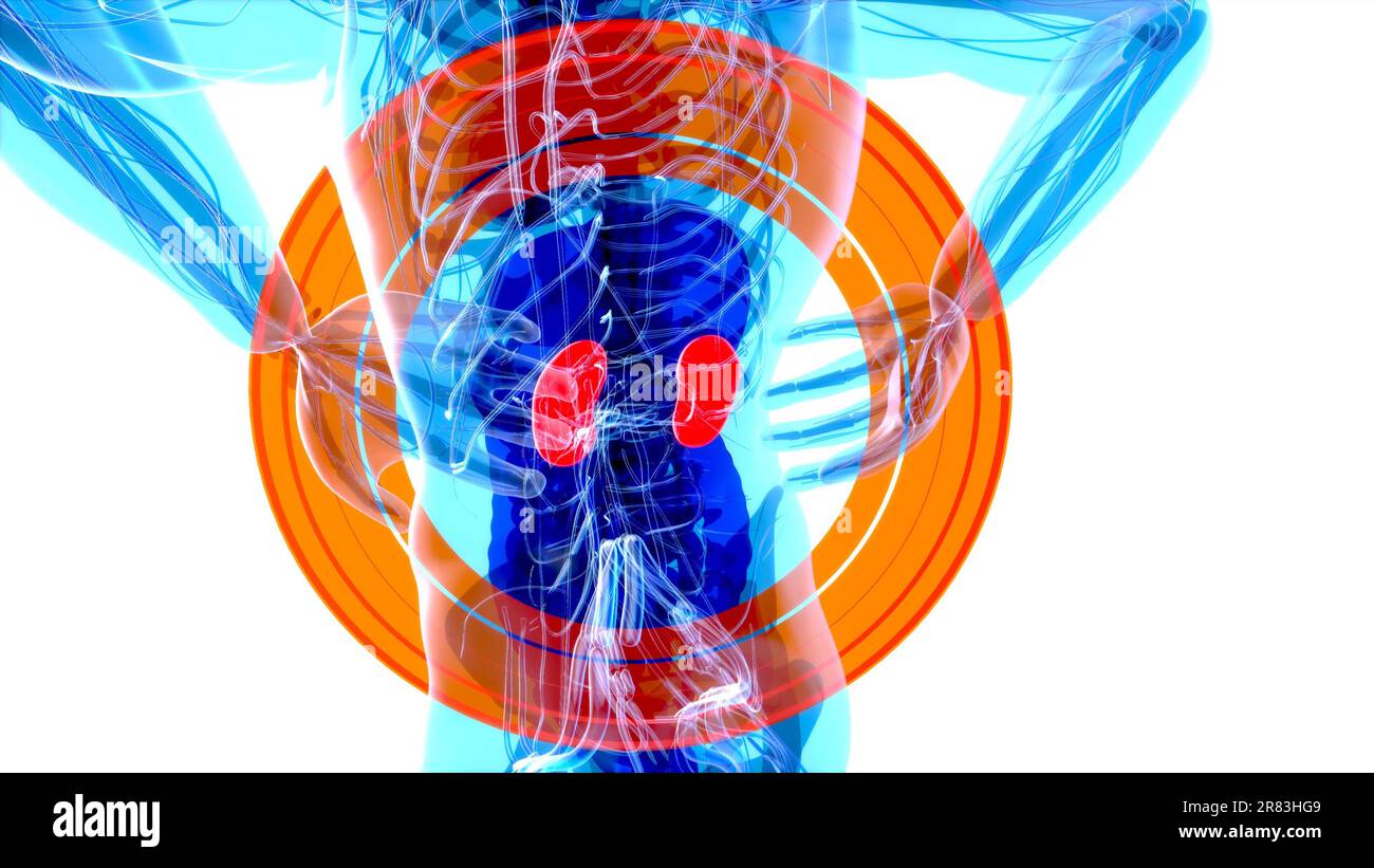 Abstract motion design of backpain and kidneys Stock Photo - Alamy