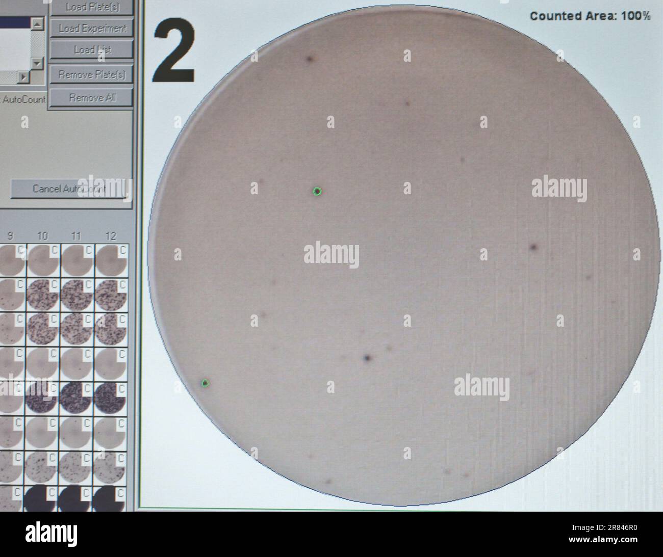 HIV vaccine experiment, conducted by Swedish professor Eric Sanstram ...