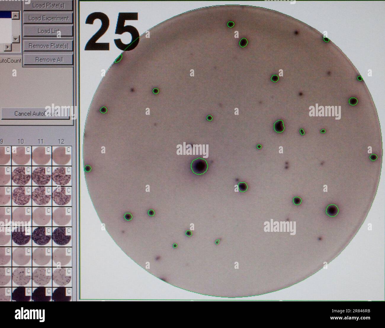 HIV vaccine experiment, conducted by Swedish professor Eric Sanstram ...