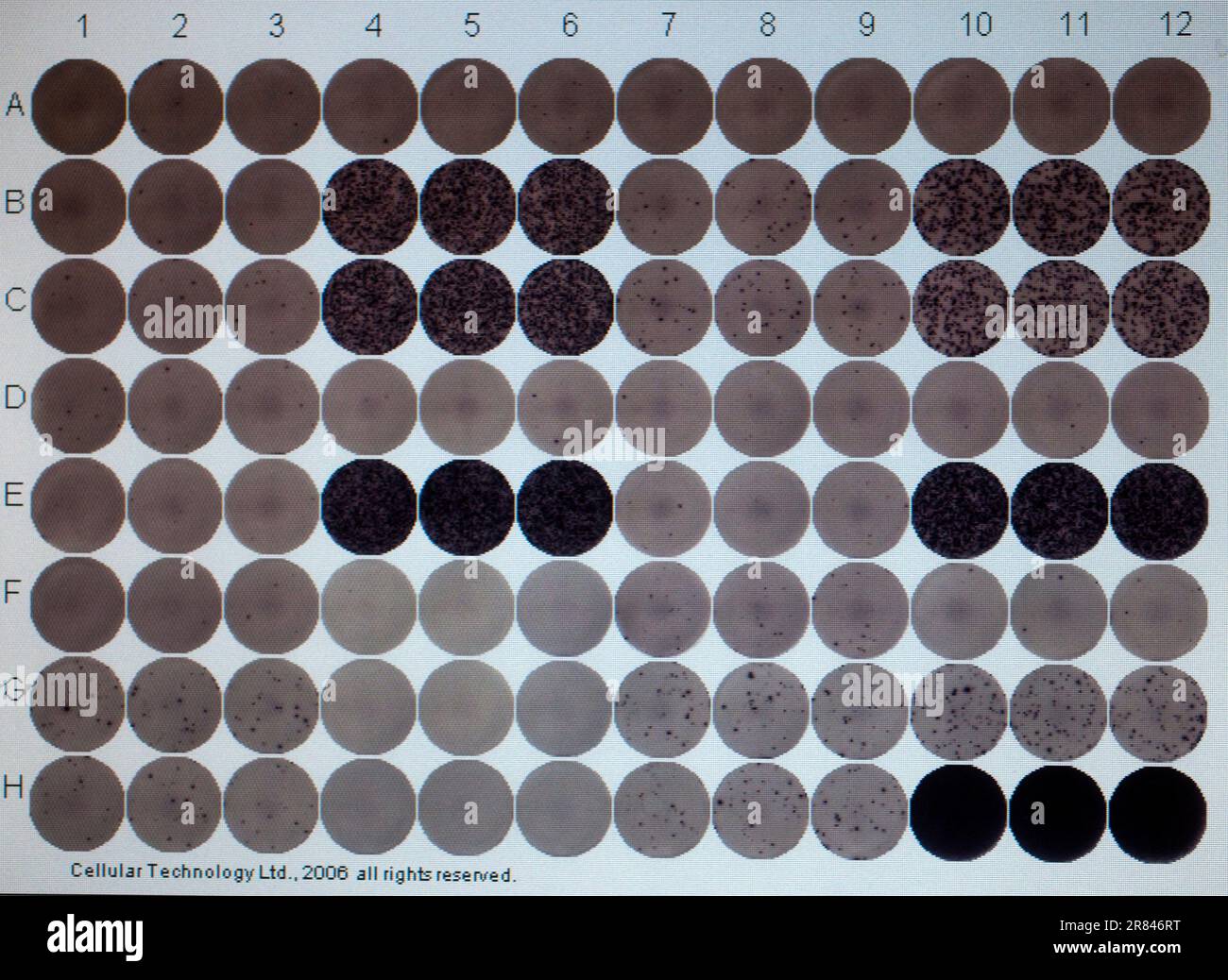 HIV vaccine experiment conducted by Swedish professor Eric Sanstram, in ...