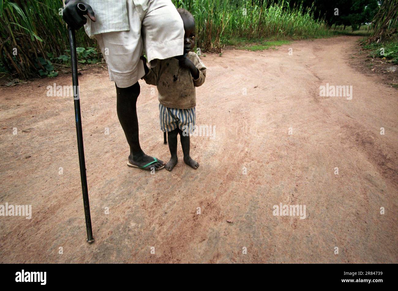 Three year old Musaf hides behind his father's lost leg, in Juba, in ...