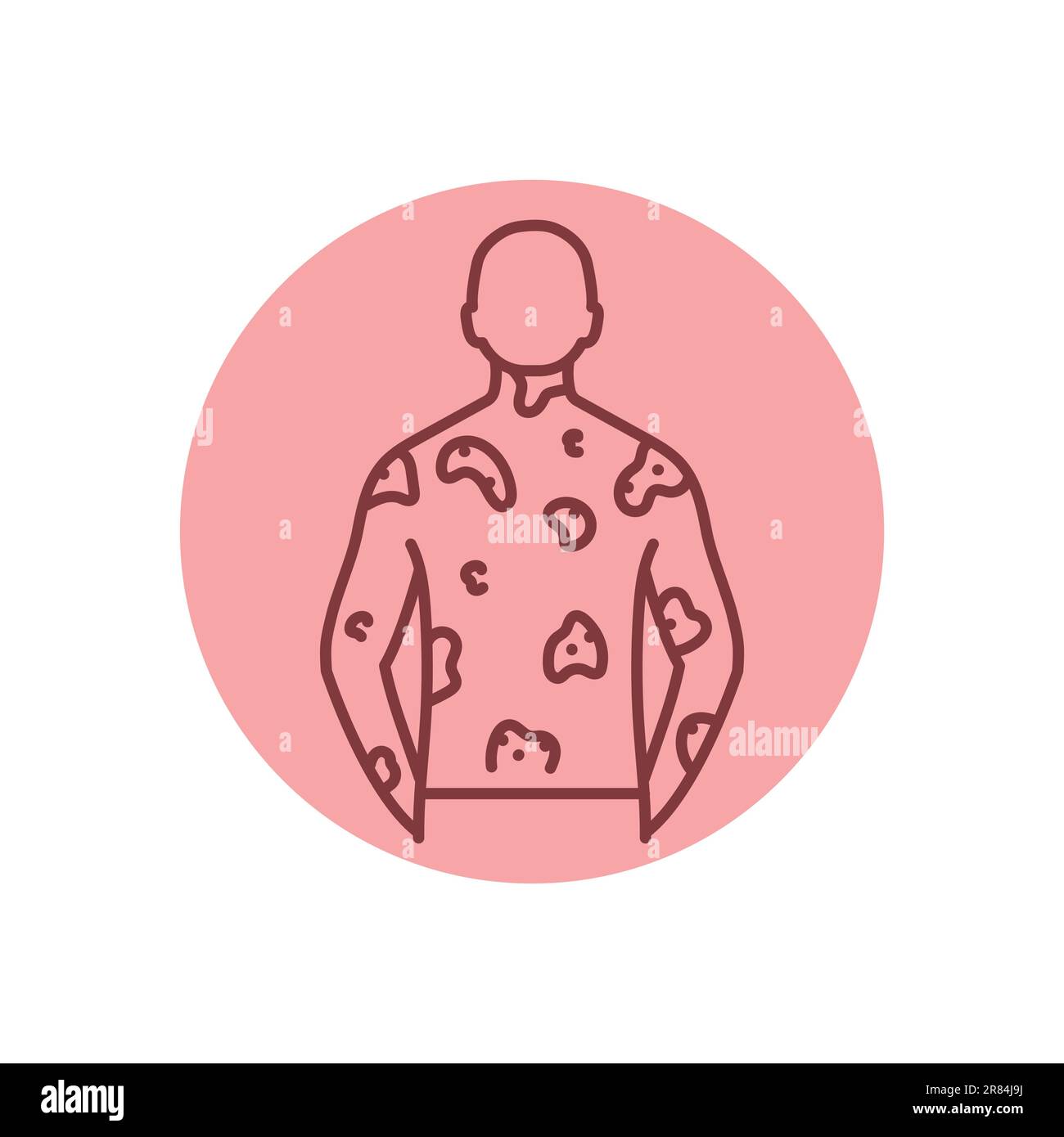 Pustular psoriasis black line icon. Autoimmune diseases. Pictogram for ...