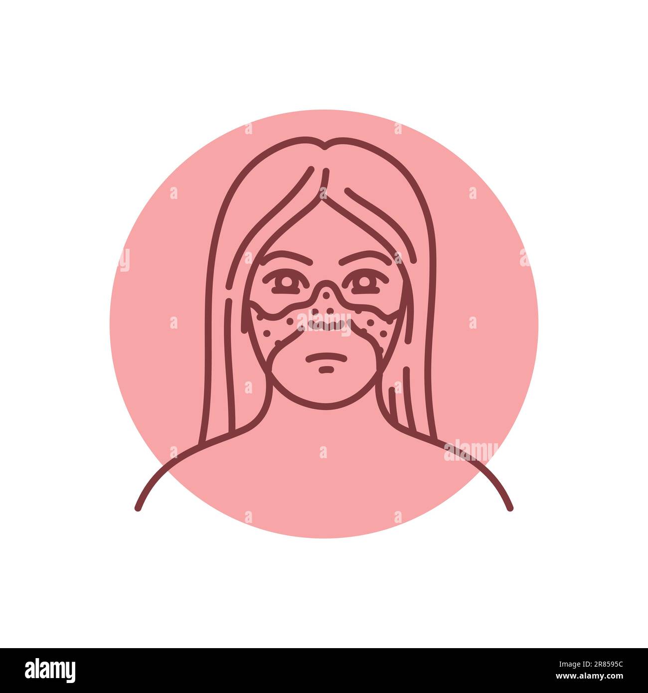 Systemic lupus erythematous Cut Out Stock Images & Pictures - Alamy