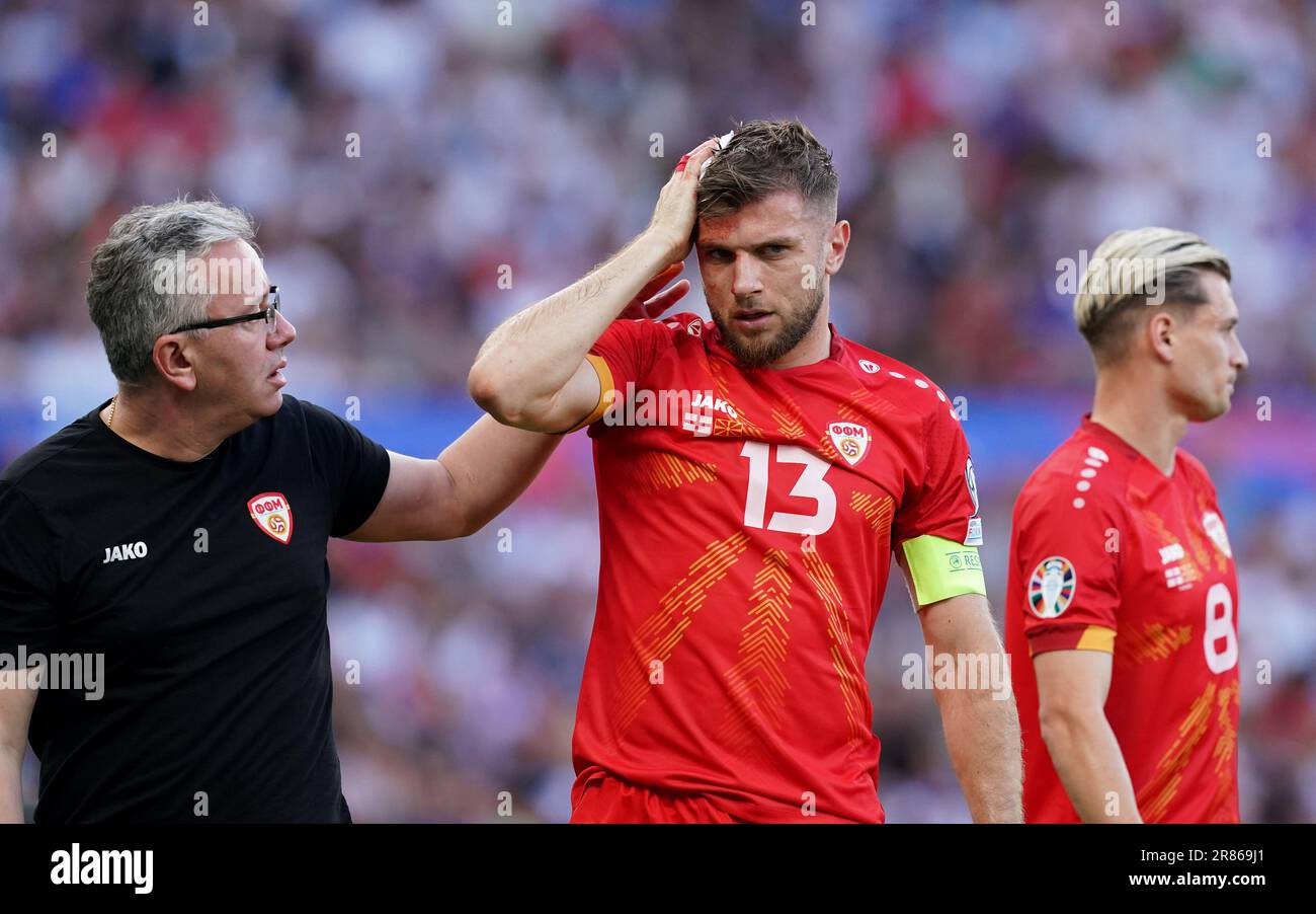 North Macedonia's Stefan Ristovski nurses a head injury after a ...