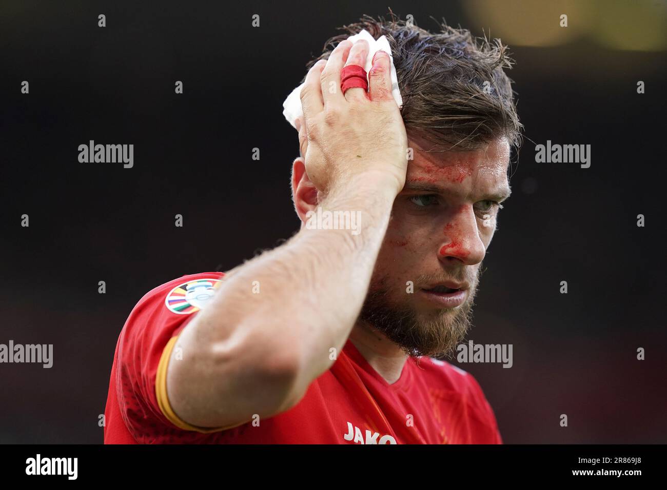 North Macedonia's Stefan Ristovski nurses a head injury after a ...