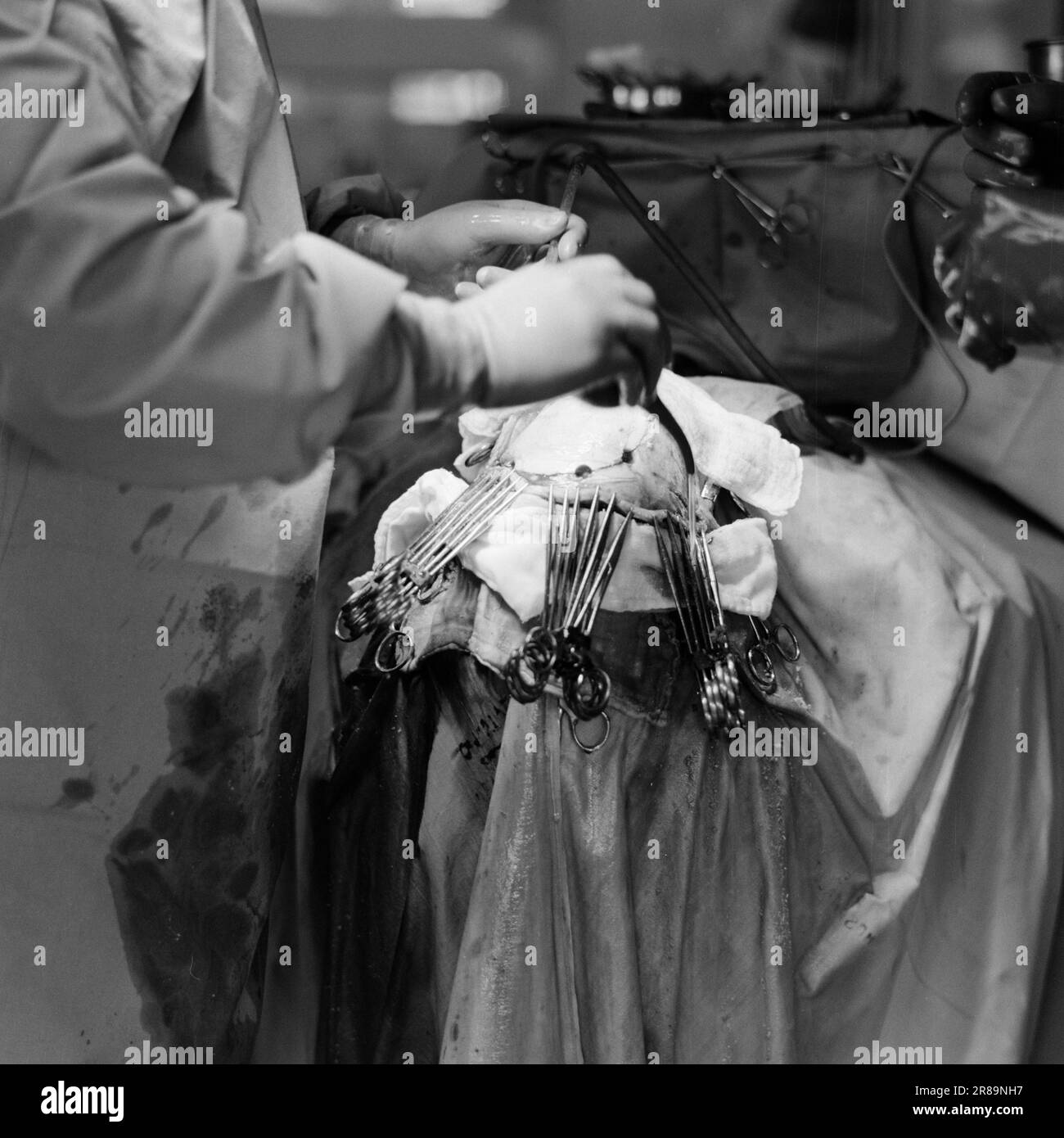 Current 16-9-1960: A glimpse into the brain For five hours the surgeon ...