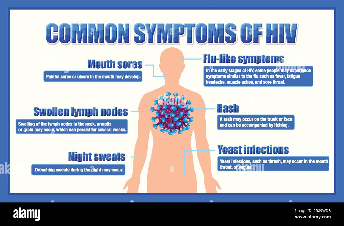 Informative poster of common symptoms of HIV illustration Stock Vector ...