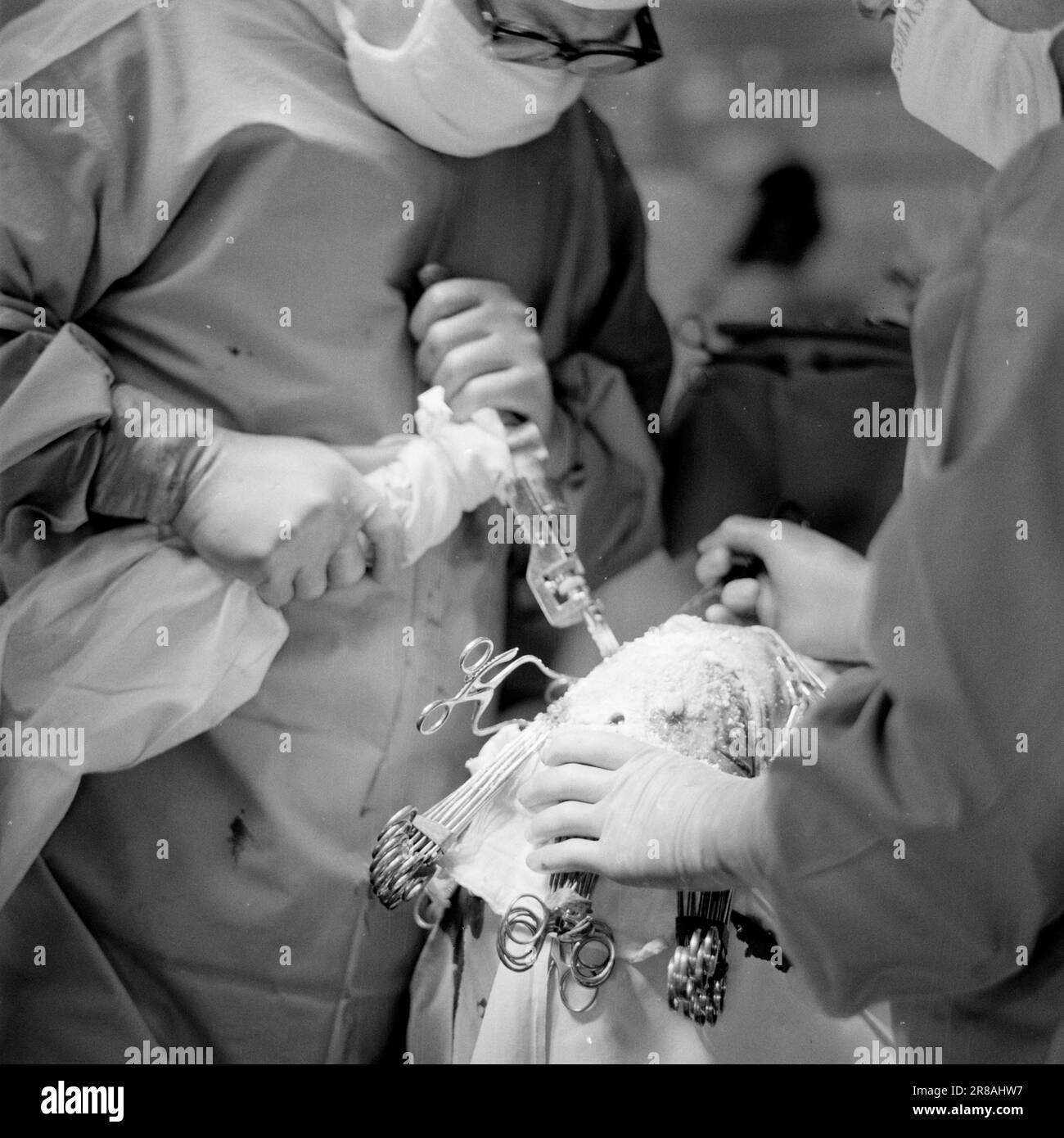 Current 16-9-1960: A glimpse into the brain For five hours the surgeon ...