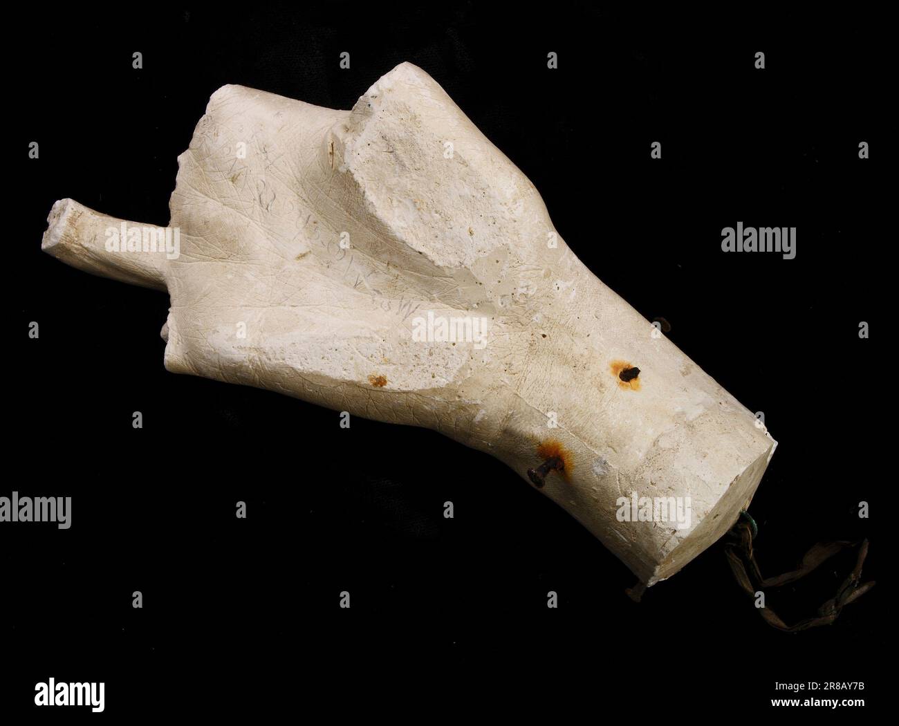 Cast of Mrs. Marshall Wood's Left Hand (all fingers missing, half of ...