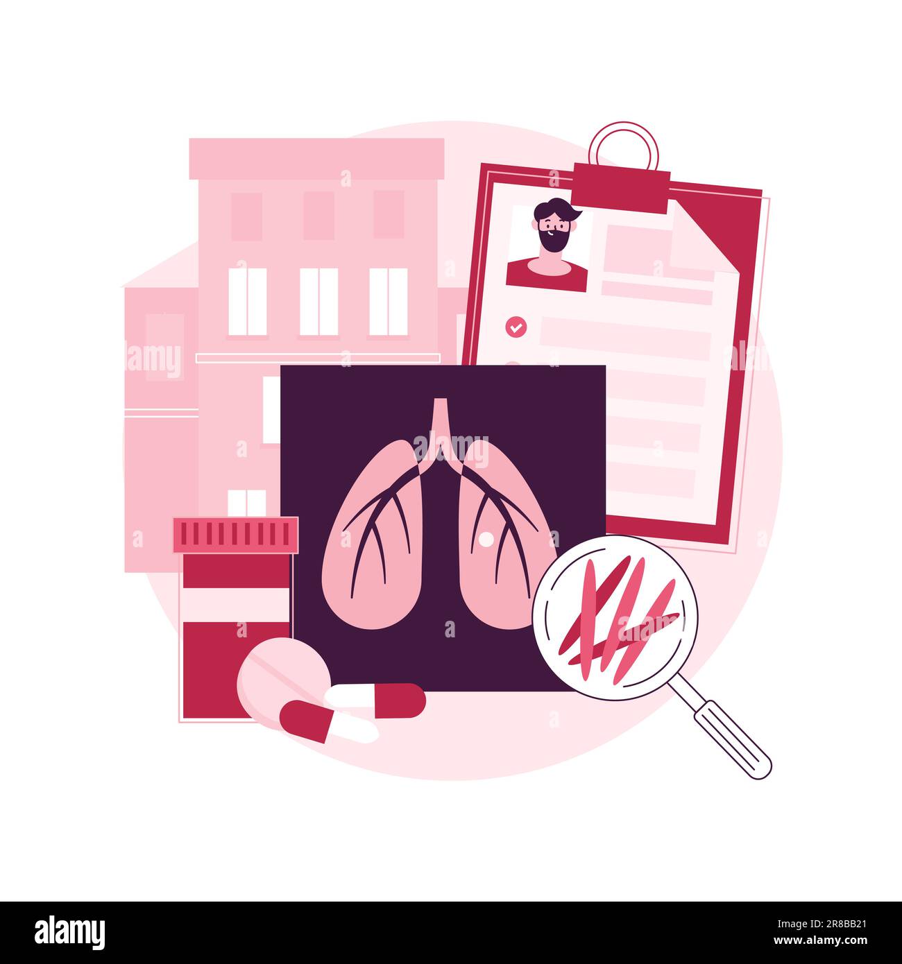 Tuberculosis abstract concept vector illustration. World tuberculosis ...