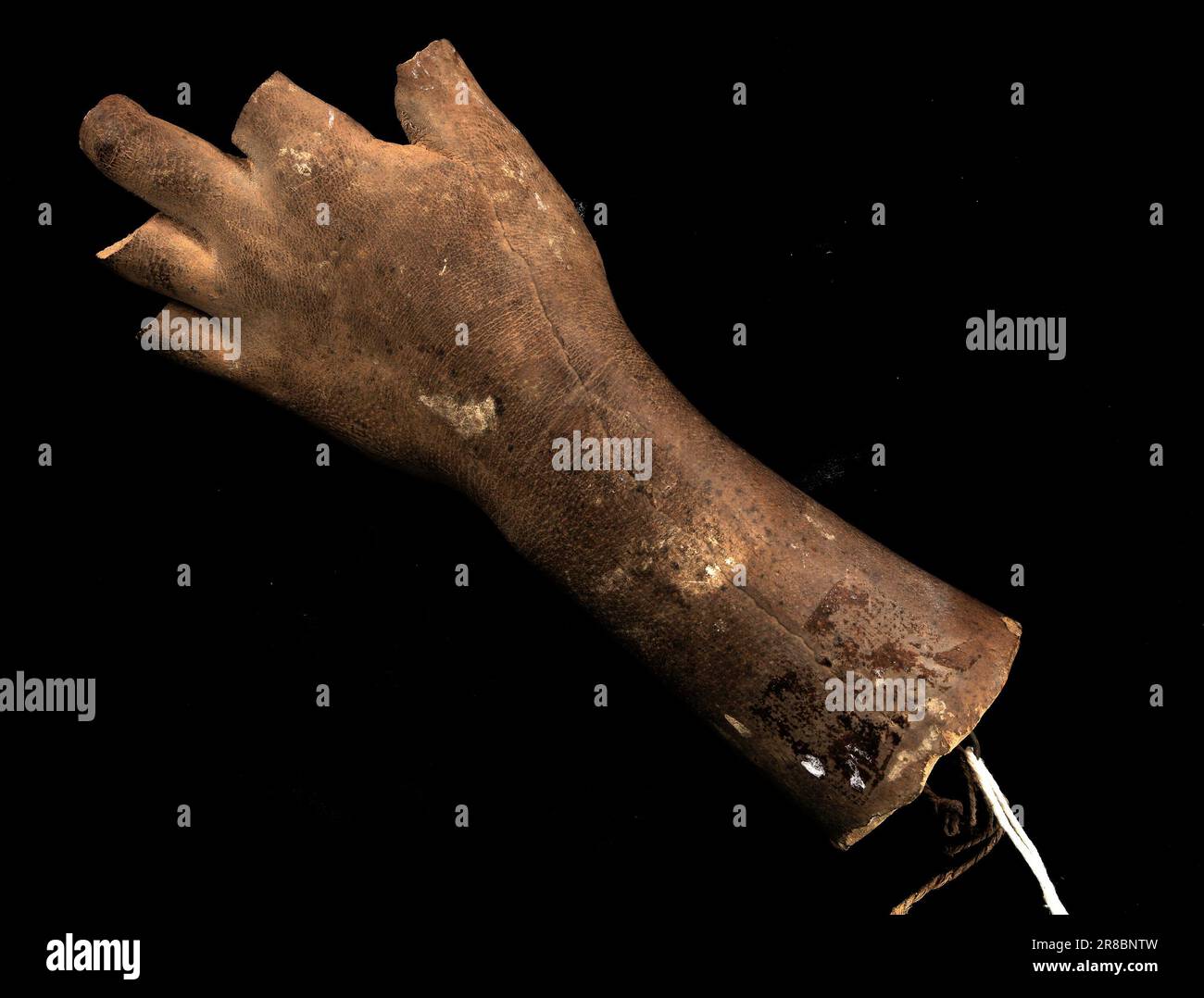 Cast of an Unidentified Child's Left Hand and Forearm (all fingers ...