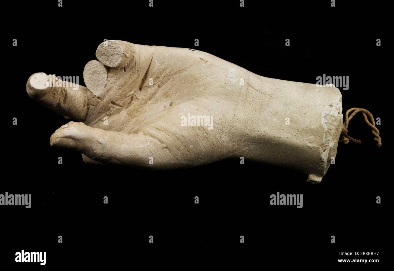 Cast of an Unidentified Left Hand, Fingers Partially Drawn Under (thumb ...