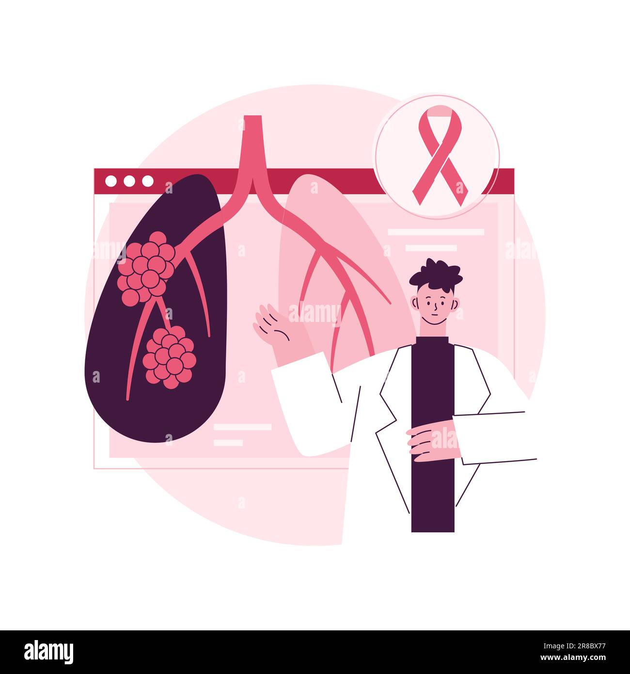 Lung cancer abstract concept vector illustration. Oncology early stage ...