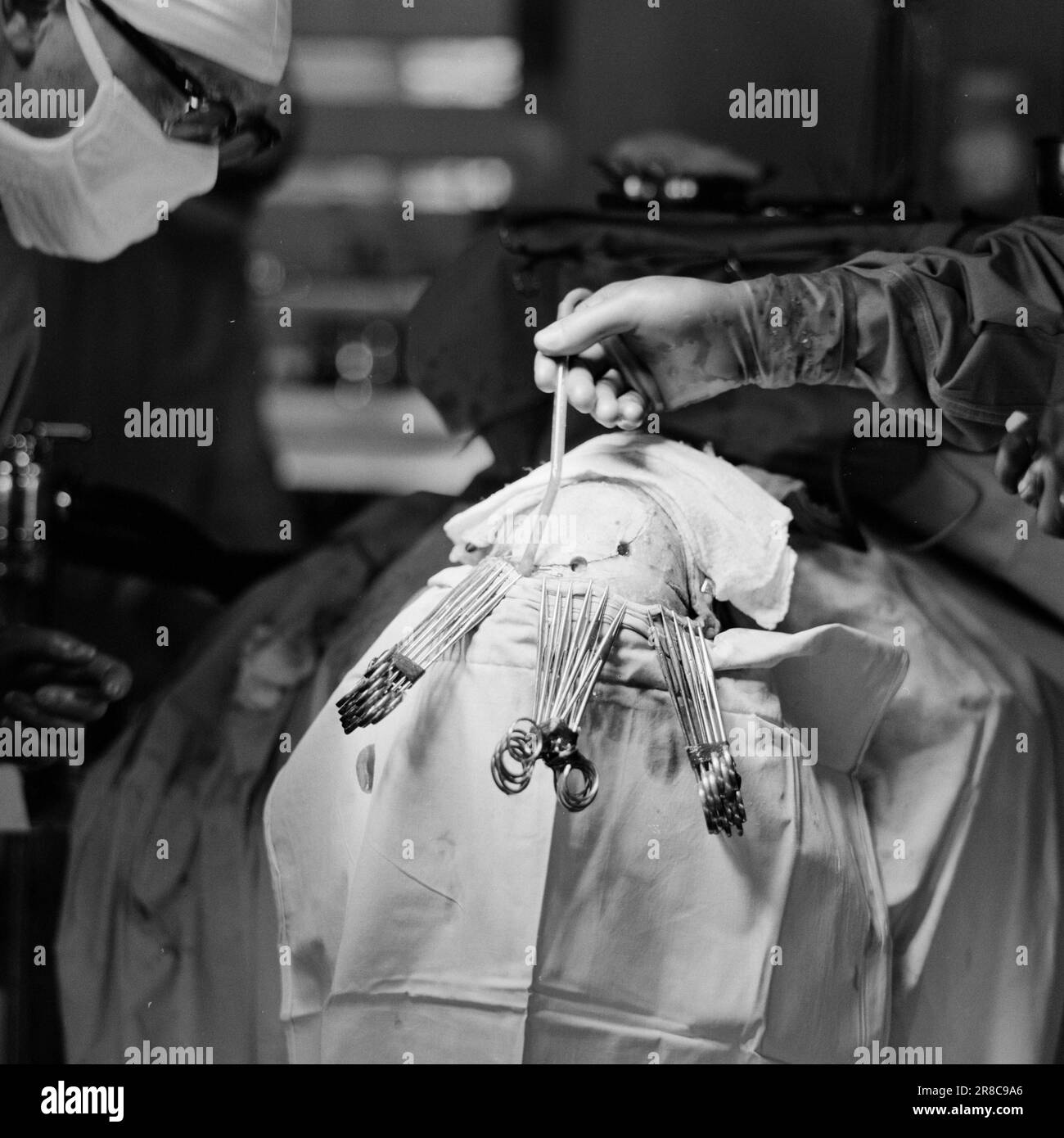 Current 16-9-1960: A glimpse into the brain For five hours the surgeon ...