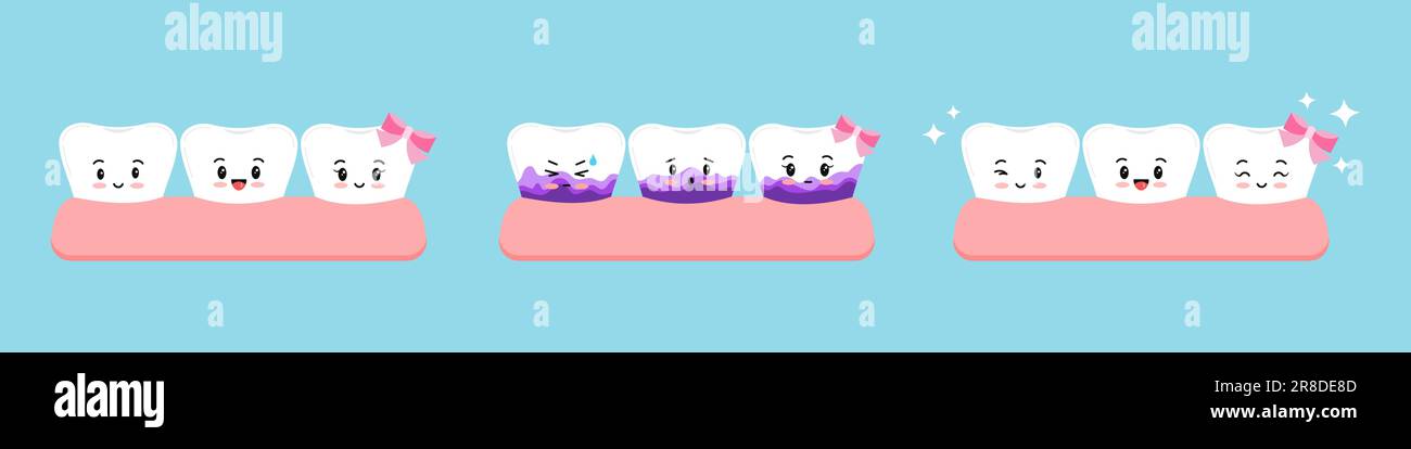 White cute tooth and with yellow tartar before after plaque test icon ...