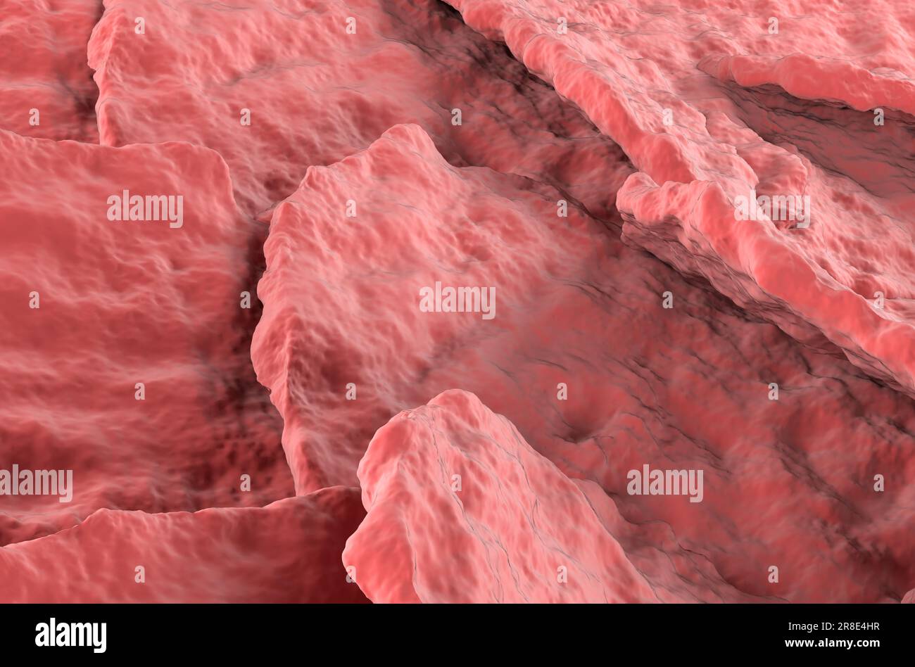 Psoriasis skin surface - closeup view 3d illustration Stock Photo - Alamy