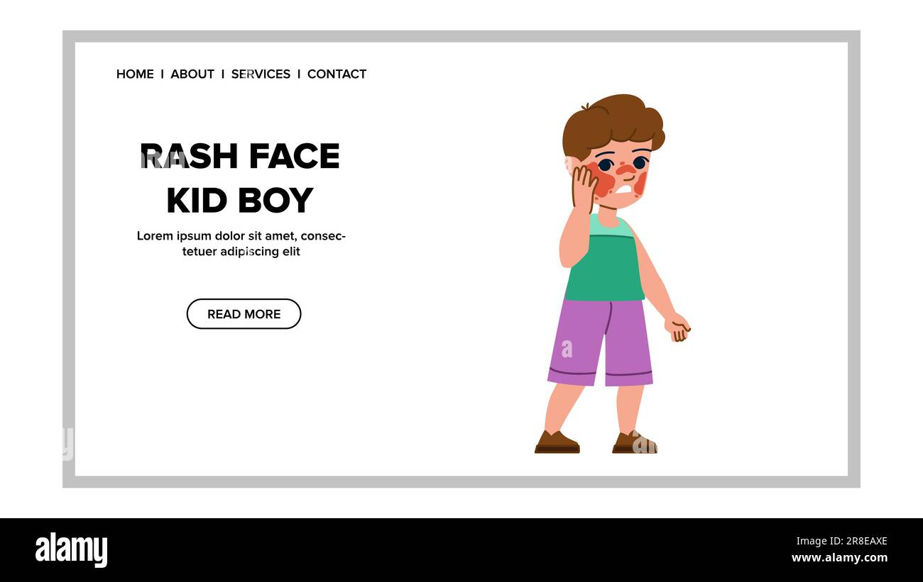 rash face kid boy vector Stock Vector Image & Art - Alamy