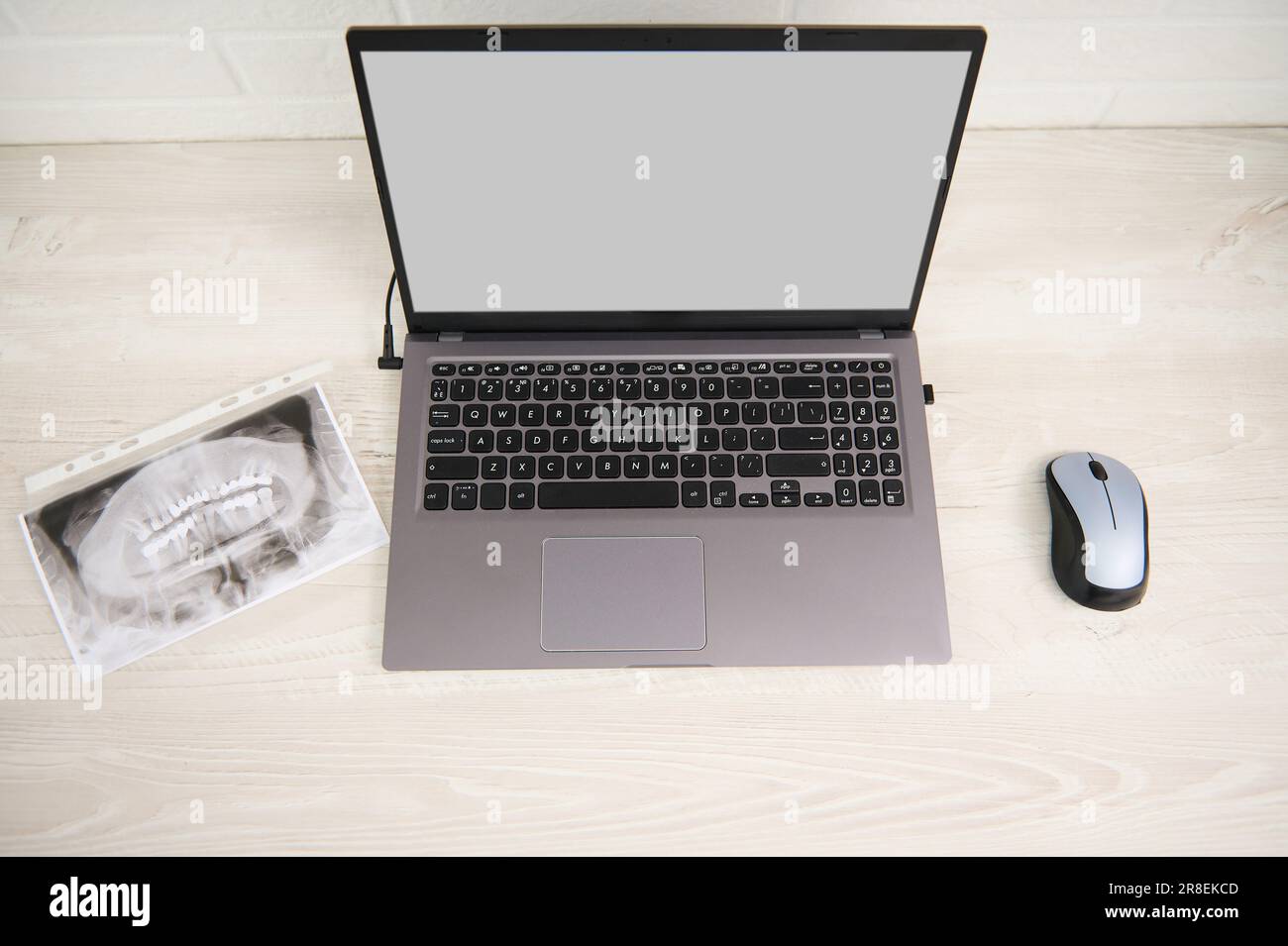 Top view panoramic X-ray photograph next to a laptop with blank digital ...