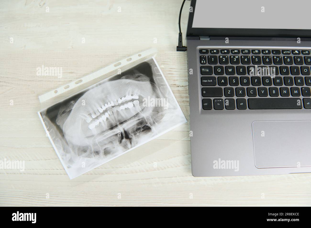 Orthopantomogram of human teeth, panoramic x-ray, next to a laptop with ...