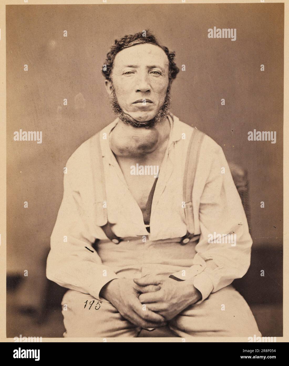 Innominate artery hi-res stock photography and images - Alamy