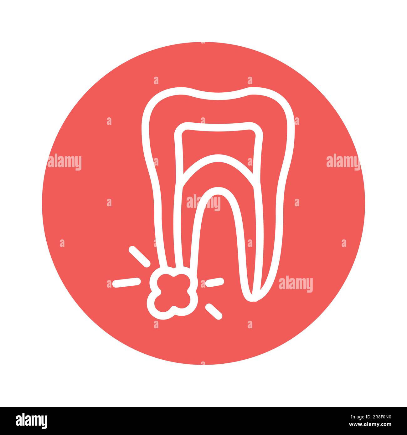 Dental Cyst Stock Vector Images Alamy
