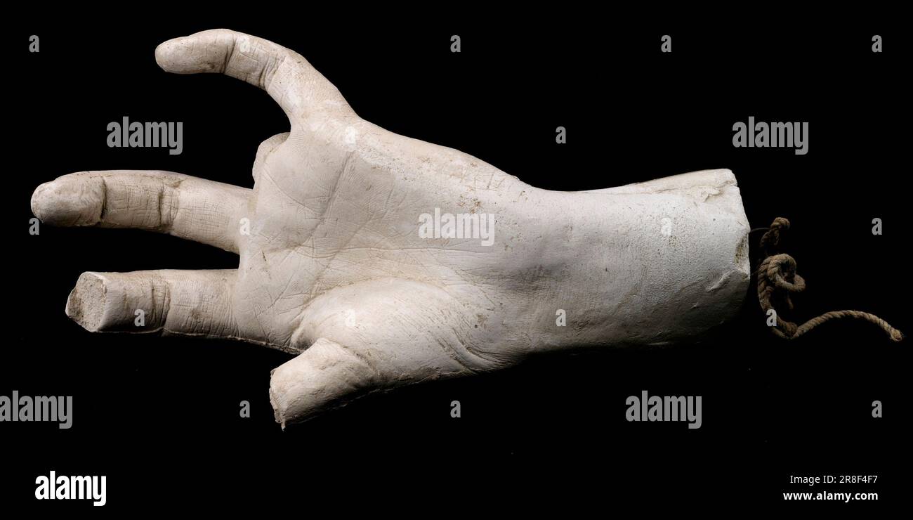 Missing thumb hi-res stock photography and images - Alamy