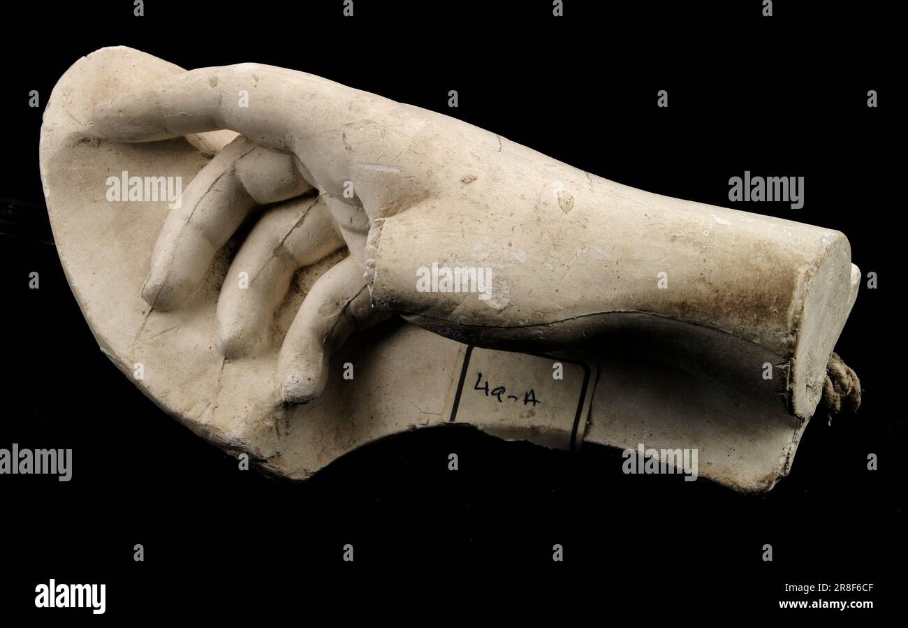 Missing thumb hi-res stock photography and images - Alamy