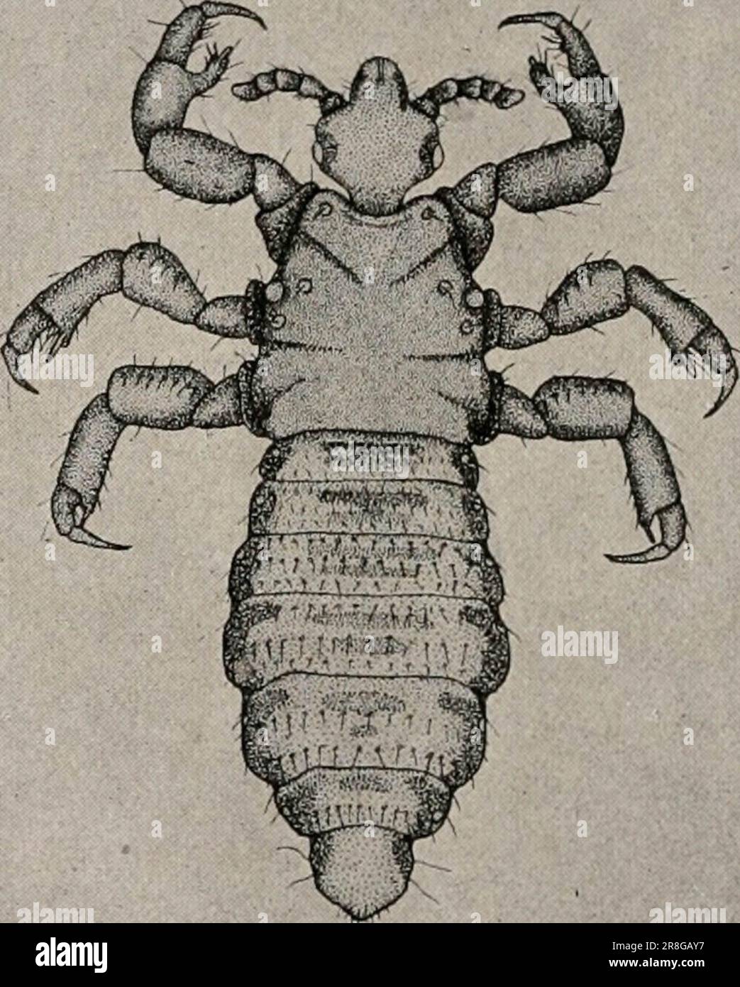 Body louse hi-res stock photography and images - Alamy