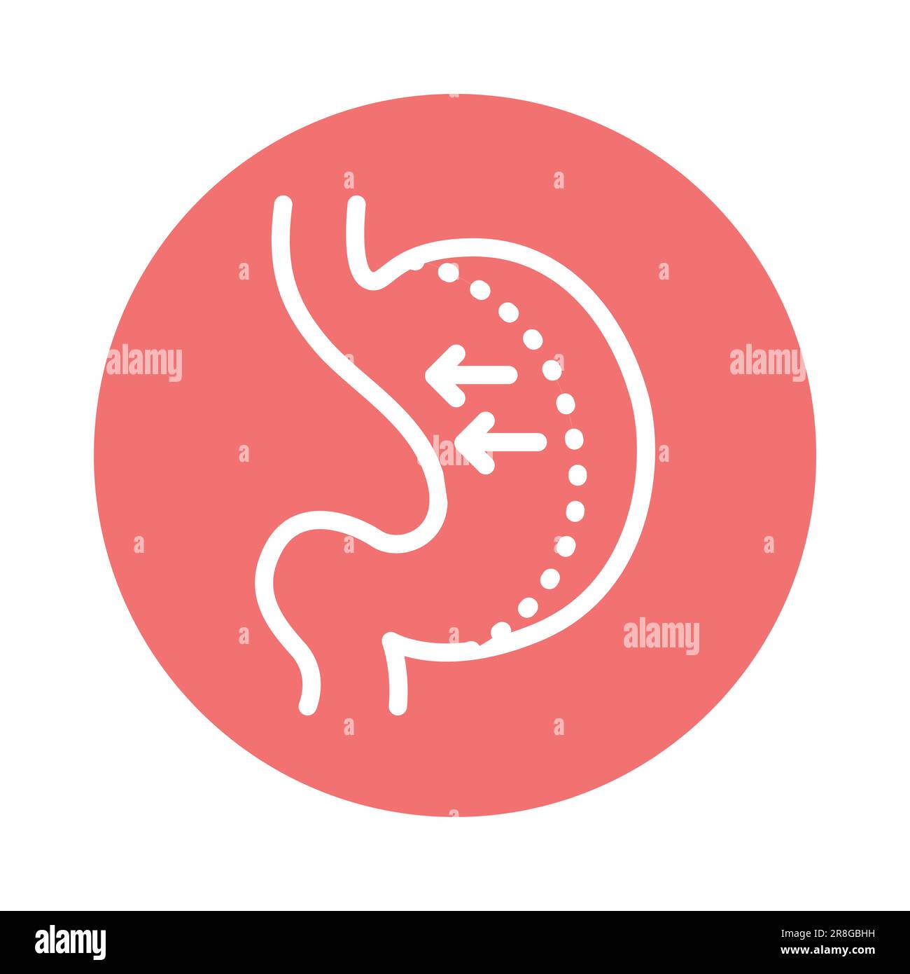 Sleeve gastrectomy color line icon. Isolated vector element. Outline ...