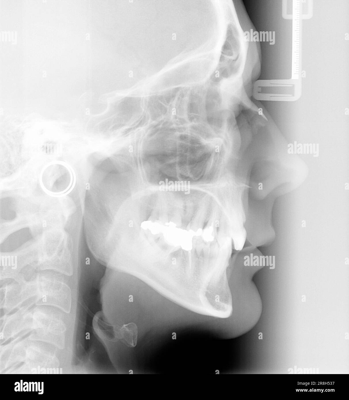 X ray examinations hi-res stock photography and images - Alamy