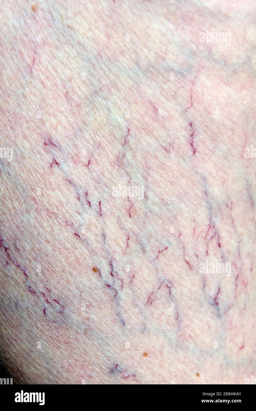 Blood circulation hi-res stock photography and images - Alamy