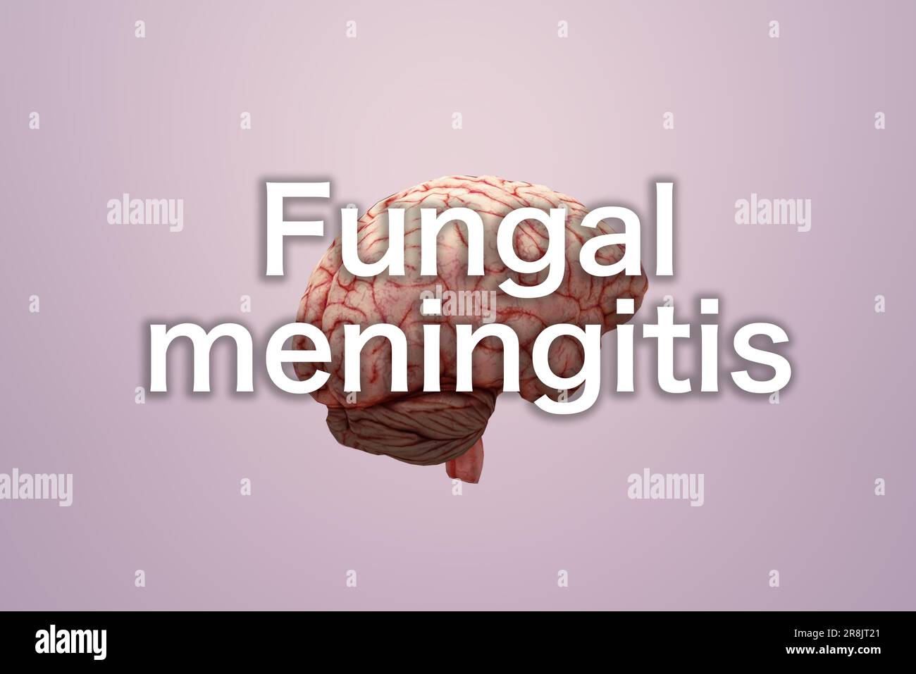 Background of fungal meningitis,Meningitis symptoms,Bacterial ...