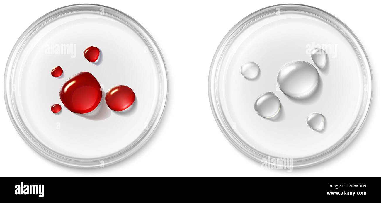 Blood smear glass Stock Vector Images - Alamy