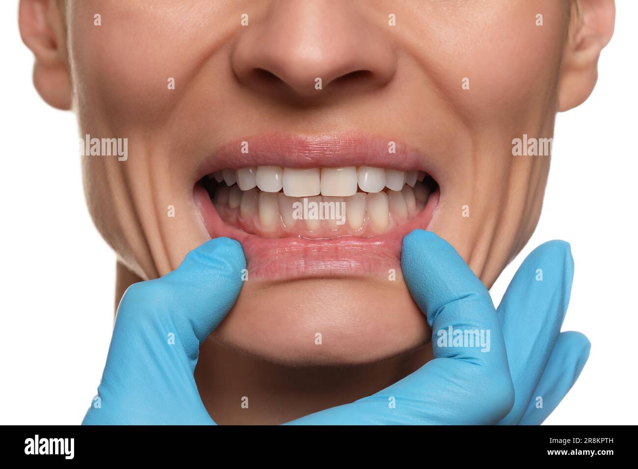 Doctor examining woman's gums on white background, closeup Stock Photo ...