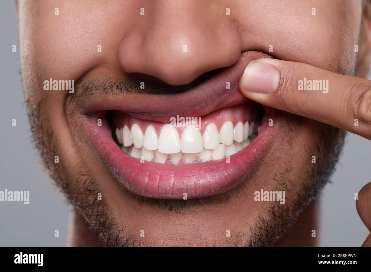 Man showing healthy gums on grey background, closeup Stock Photo - Alamy
