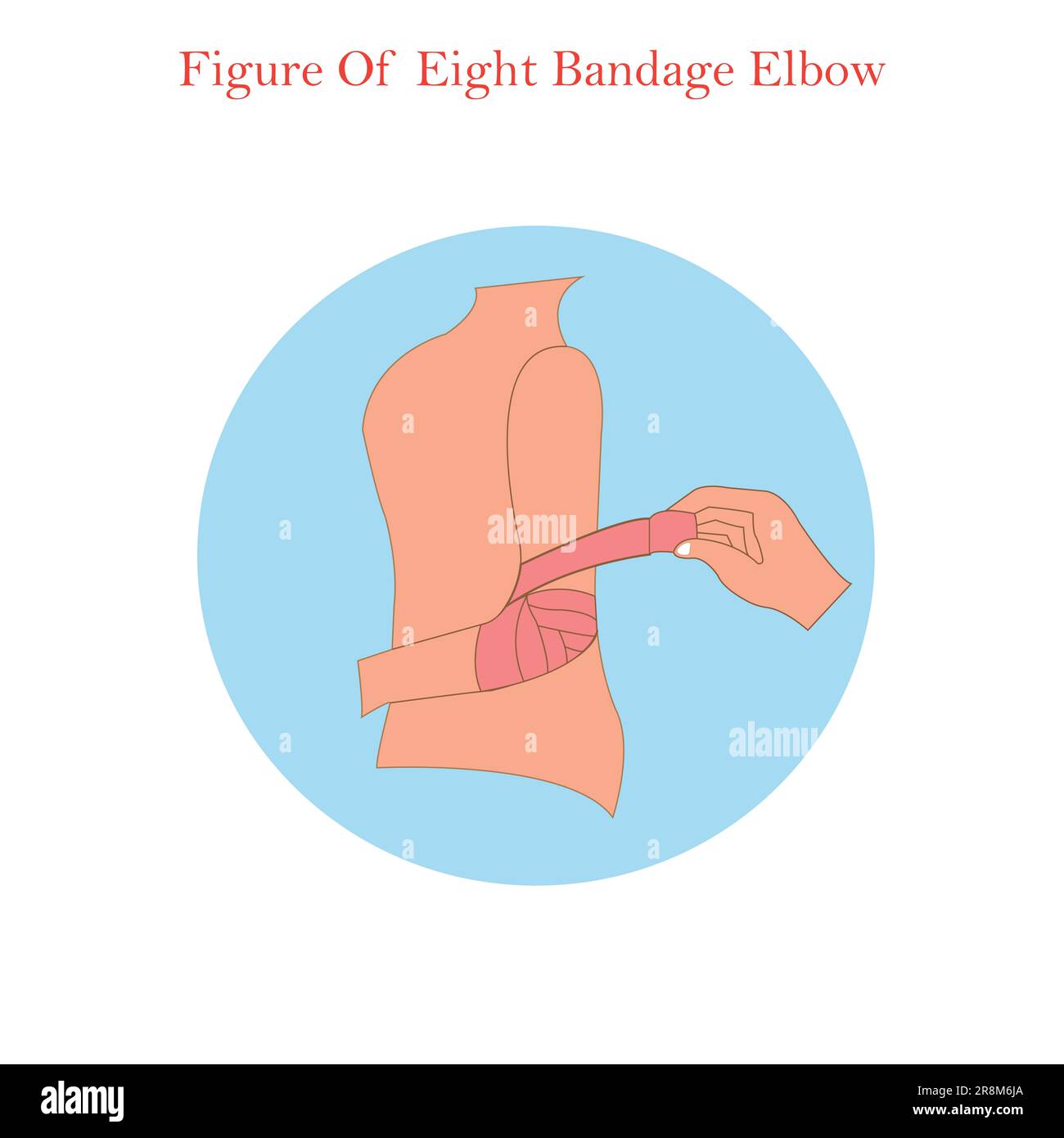 A digital illustration of a medical first aid poster featuring a figure ...